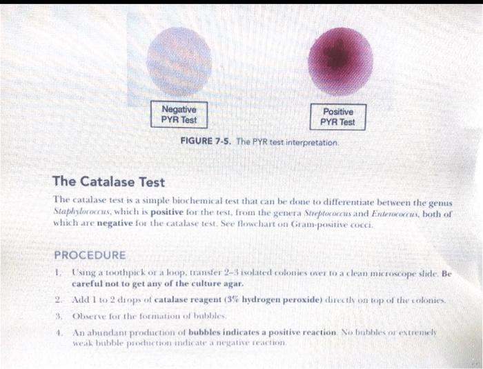 Solved The PYR (Pyrolidonyl Arylamidase) Test The PYR test | Chegg.com
