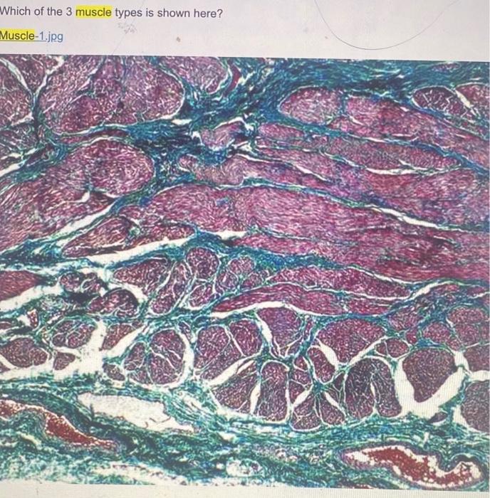 Solved Which of the 3 muscle types is shown here? | Chegg.com