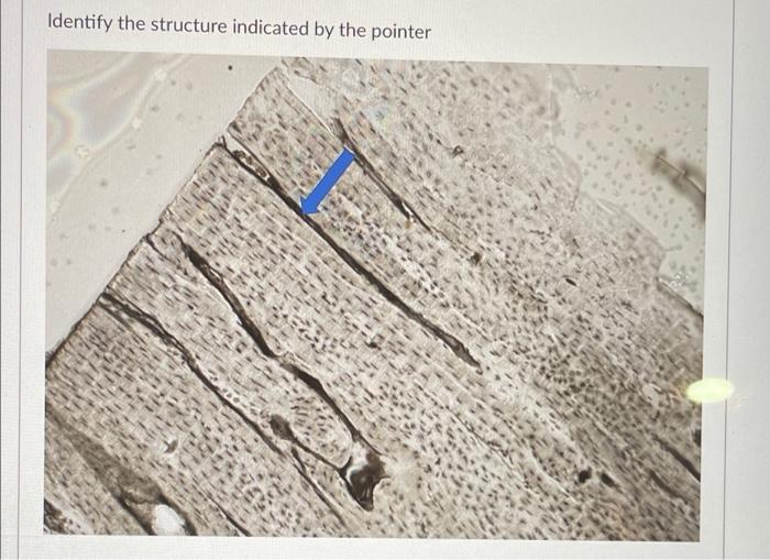 Solved Identify the structure indicated by the pointer | Chegg.com