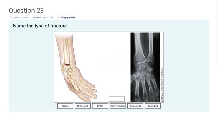 Name the joint. Name the type of fracture. Name the | Chegg.com