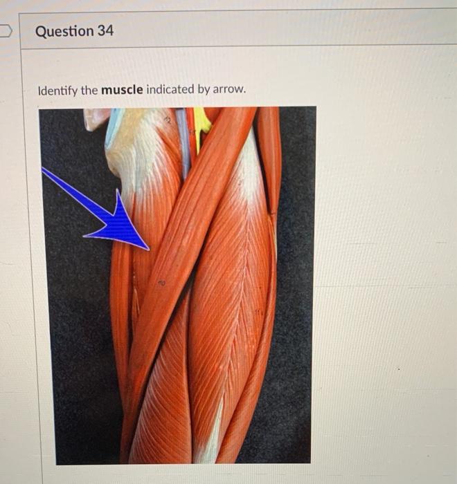Solved Identify the muscle indicated by arrow. Identify the | Chegg.com