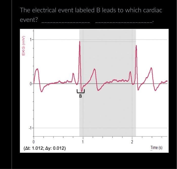 Solved The electrical event labeled B leads to which cardiac | Chegg.com