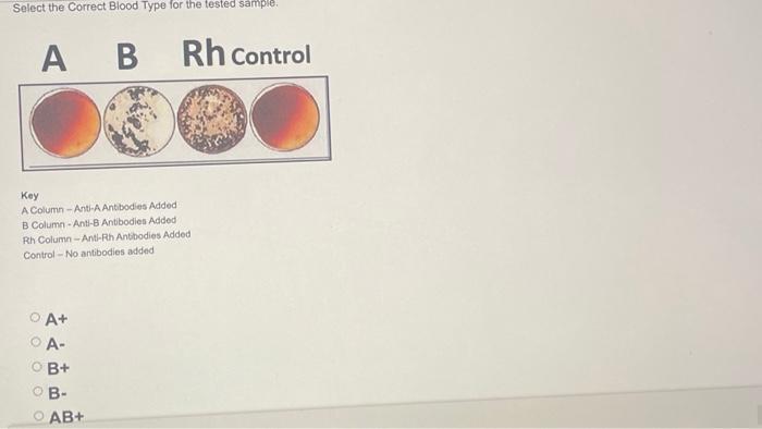 [Solved]: Select the Correct Blood Type for the tested samp