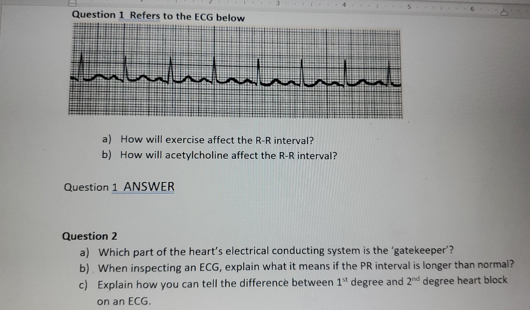 Solved a) How will exercise affect the R-R interval? b) How | Chegg.com