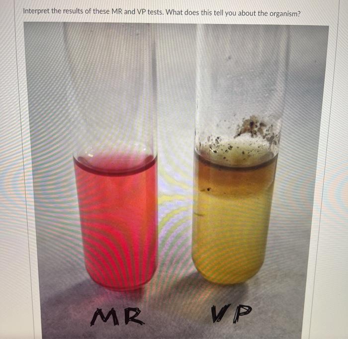 Solved Interpret the results of these MR and VP tests. What | Chegg.com