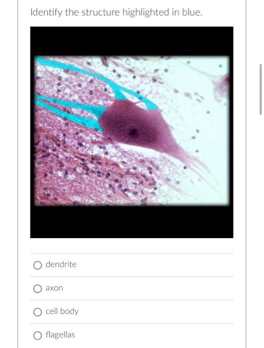 Solved In this Cardiac muscle tissues, what structures are | Chegg.com