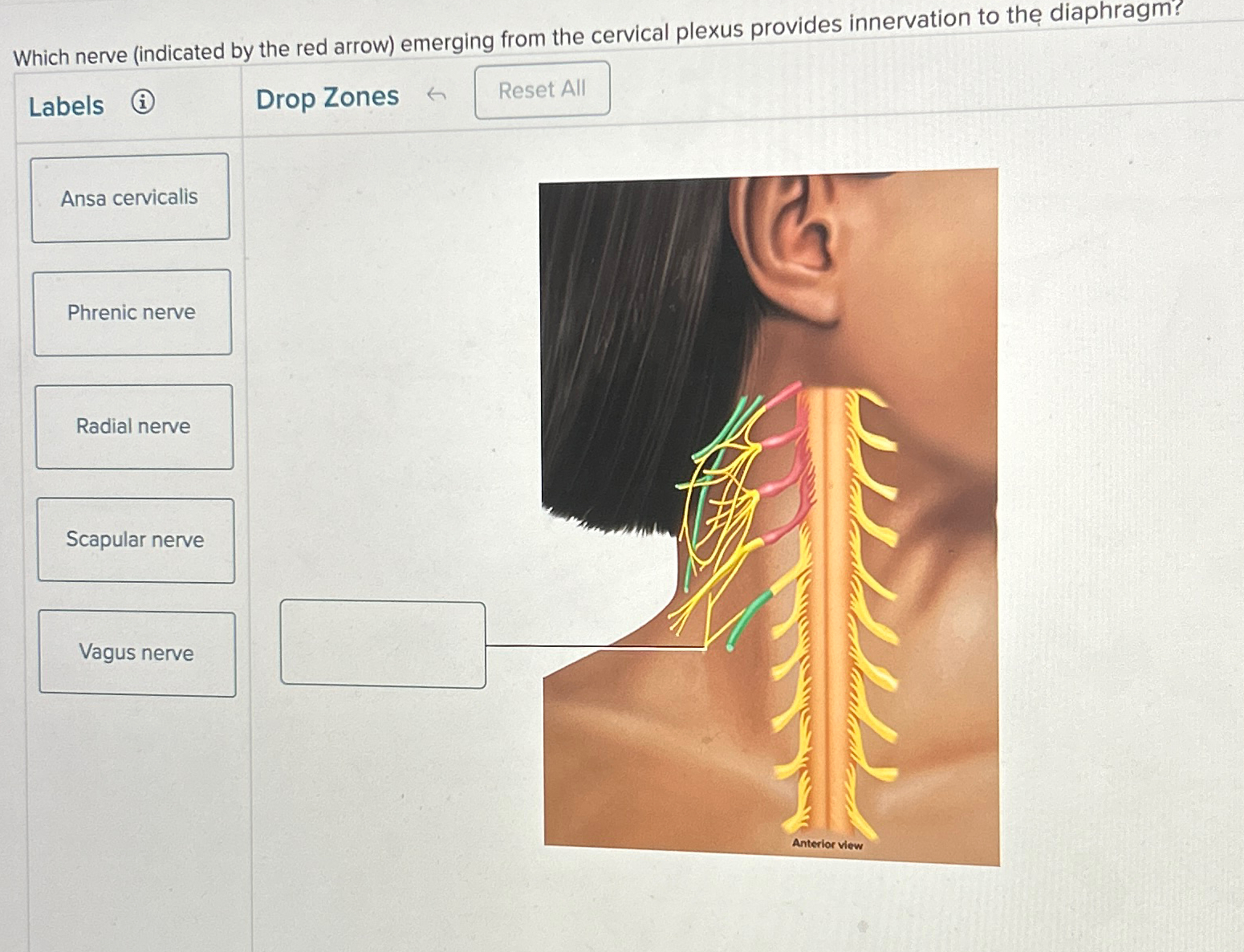 Solved Which nerve (indicated by the red arrow) ﻿emerging | Chegg.com