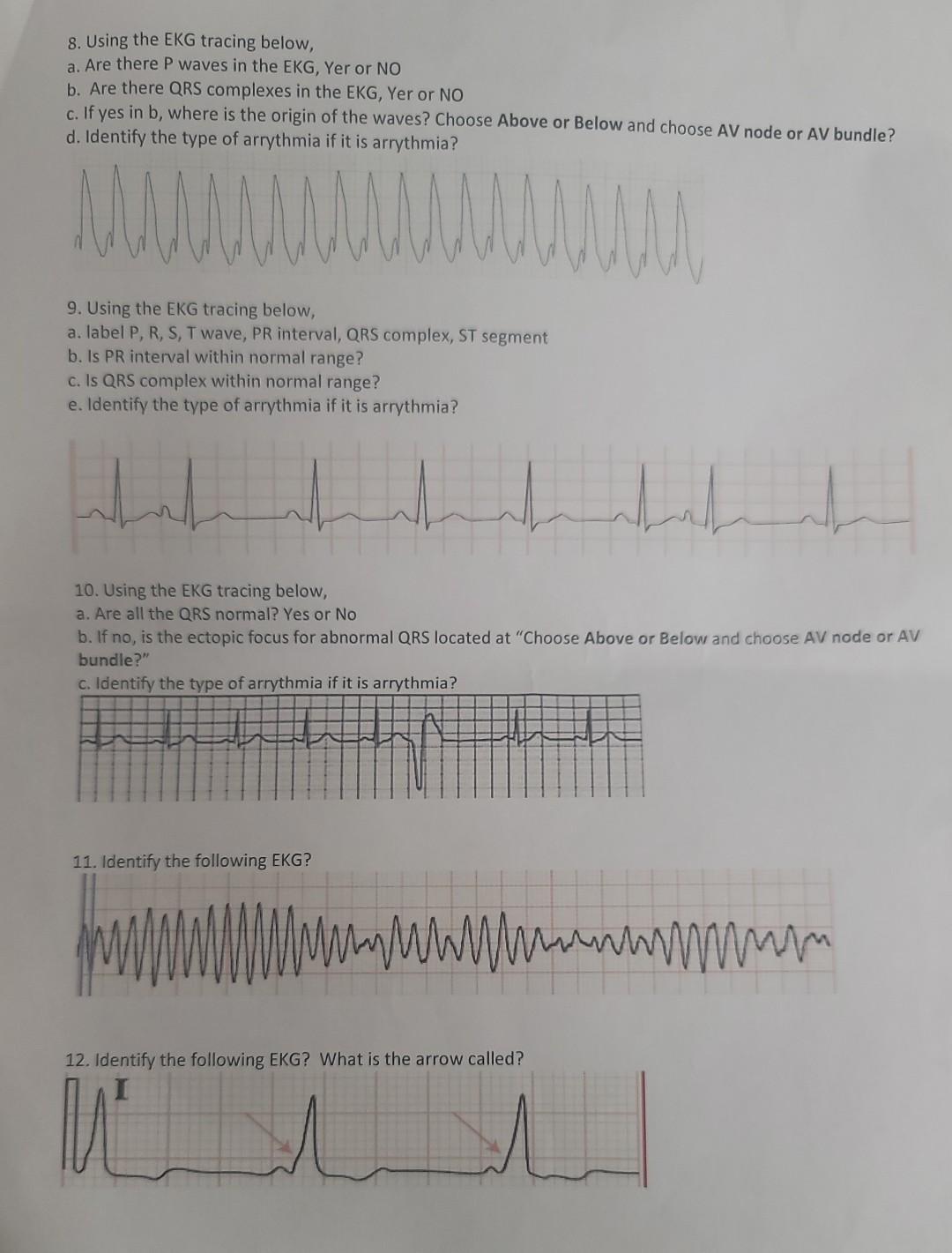 Solved 8. Using the EKG tracing below, a. Are there P waves | Chegg.com