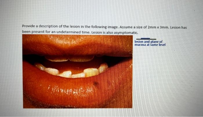 Solved Provide a description of the lesion in the following | Chegg.com
