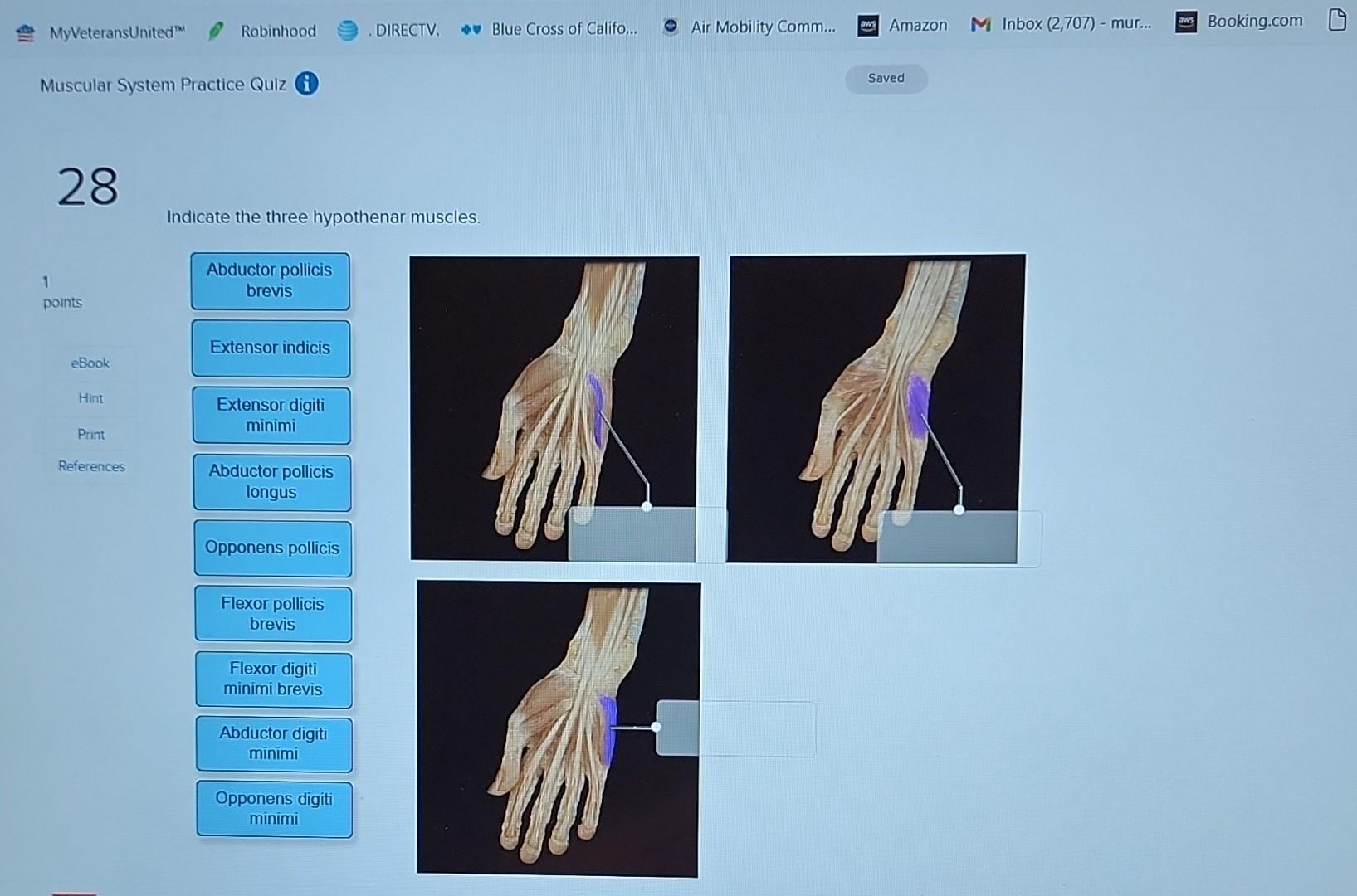 Solved Indicate the three hypothenar muscles. | Chegg.com
