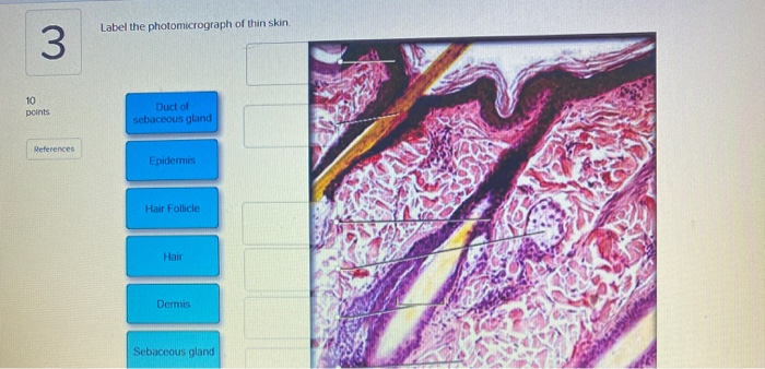 Solved Label the photomicrograph of thin skin 3 10 points | Chegg.com
