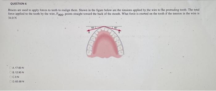 Solved Braces are used to apply forces to teeth to realign | Chegg.com