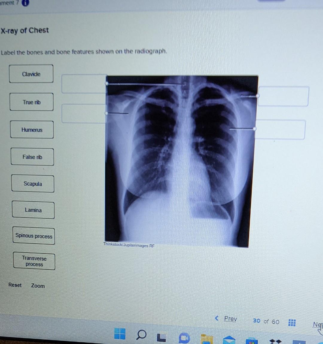 Solved Label the bones and bone features shown on the | Chegg.com