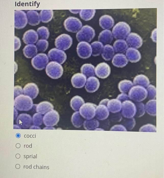 Solved Idpntify curved rods cocci spiral cocci in chains | Chegg.com
