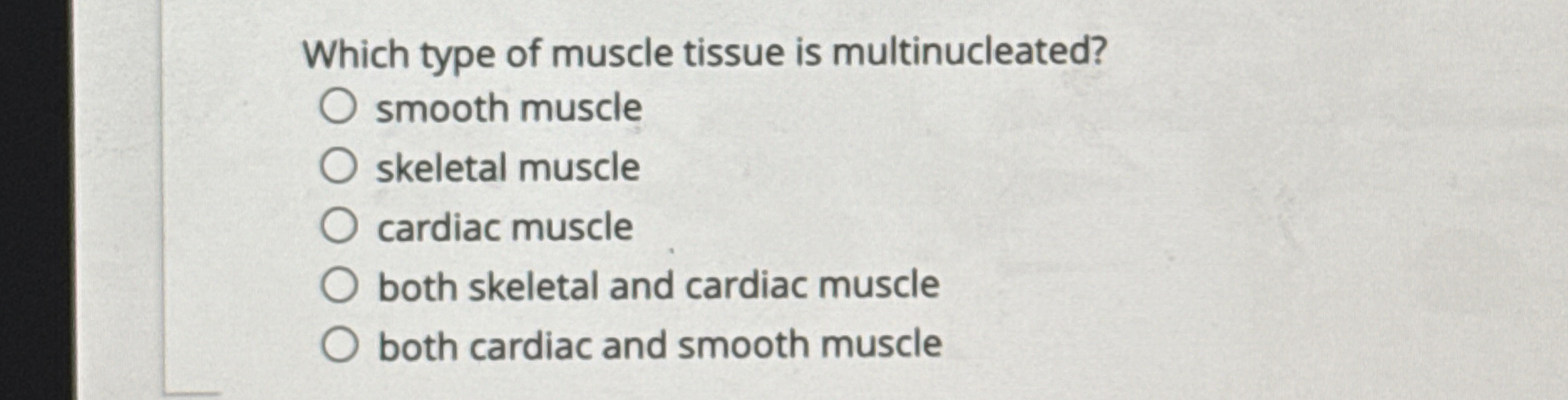 Solved Which type of muscle tissue is multinucleated?smooth | Chegg.com