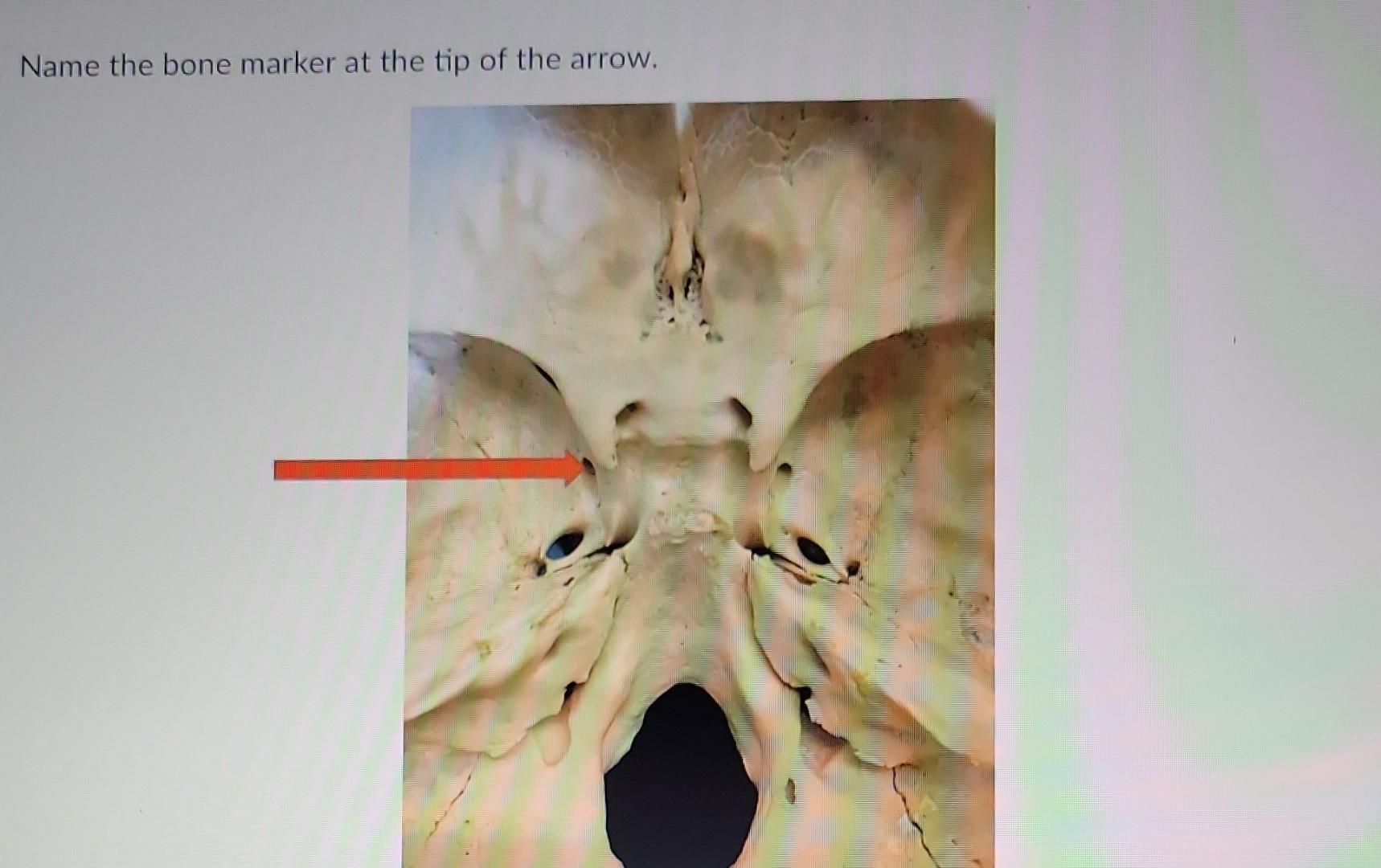 Solved Name the bone marker at the tip of the arrow. Name | Chegg.com