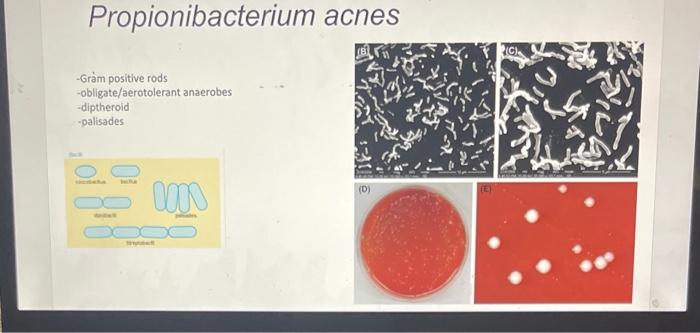 Propionibacterium Acnes Gram Stain
