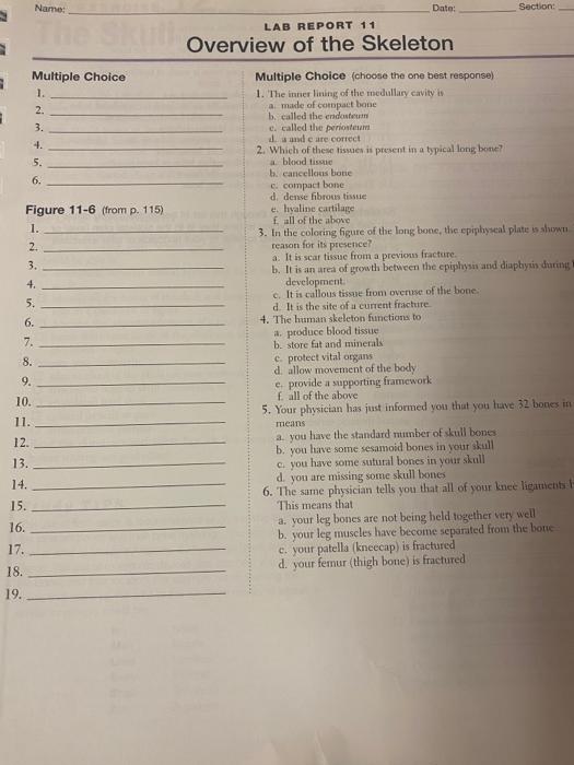 Solved Multiple Choice 1. 2. Figure 11-6 (from p. 115) 1. 2. | Chegg.com