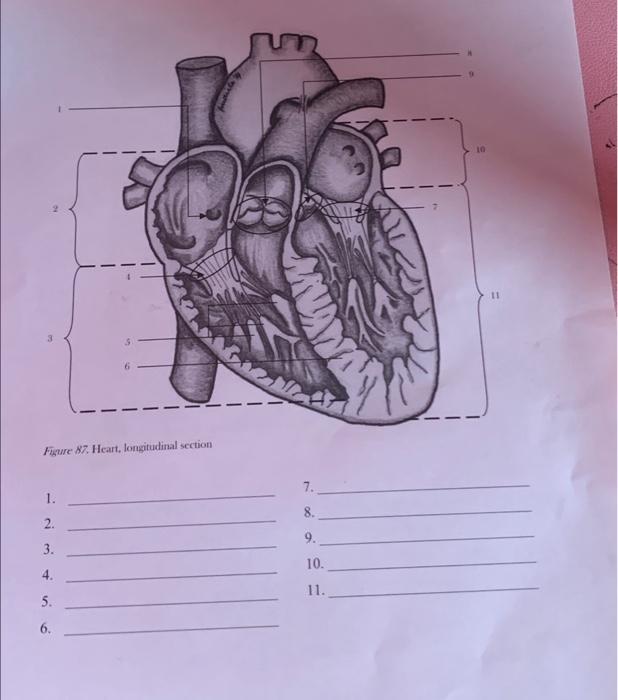 Solved 2 3 5 1. 2. 3. 4. 5. 6. 6 Figure 87. Heart, | Chegg.com
