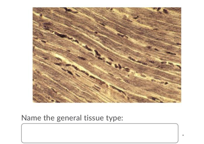 Solved 1. General tissue type: EPITHELIAL Specific tissue | Chegg.com