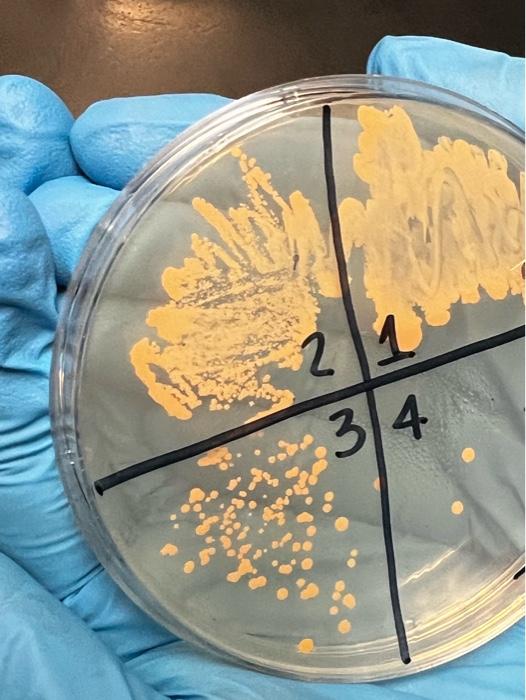 Solved Based on the quad streak and gram stain pictures, | Chegg.com
