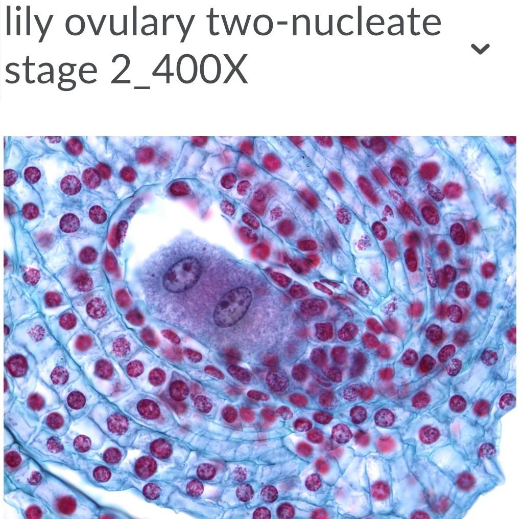 Solved lily ovulary two-nucleate stage_40X