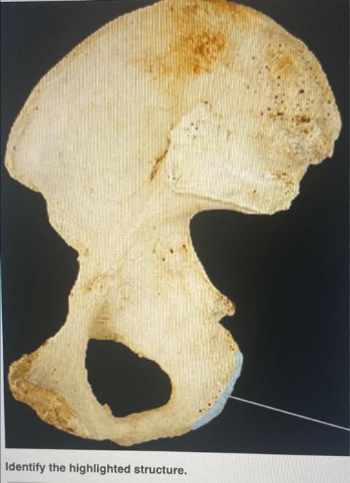 Solved 1. what is the highlighted bone?2. what is the | Chegg.com
