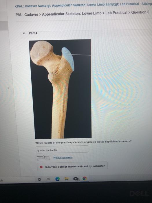 Solved Appendicular Skeleton: Lower | Chegg.com Solved Appendicular Skeleton: Lower | Chegg.com