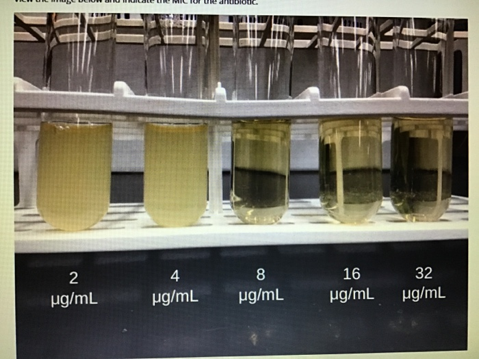 Solved ~ Look at the ZOI in the picture. This is an example | Chegg.com