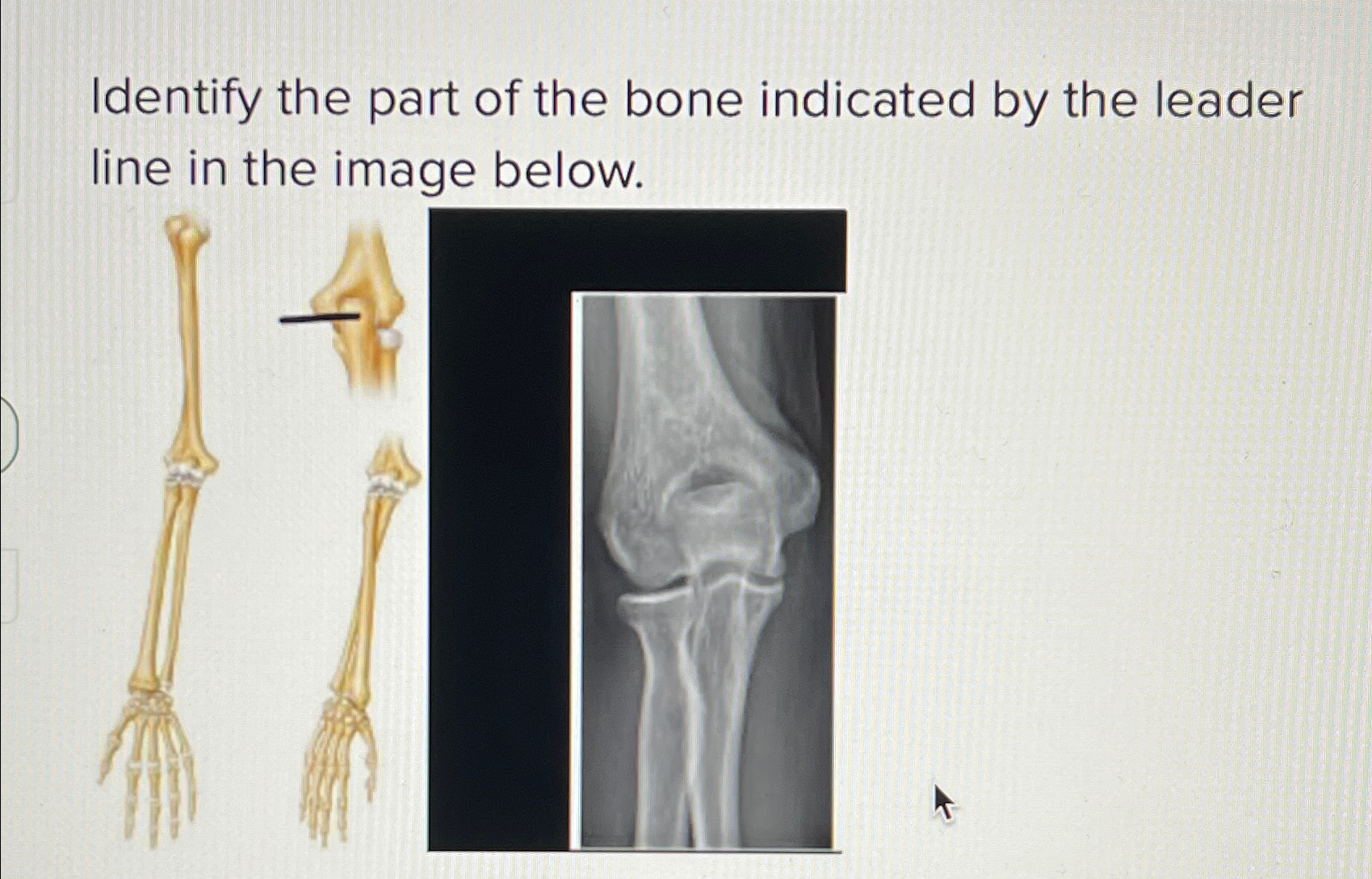 Solved Identify the part of the bone indicated by the leader | Chegg.com