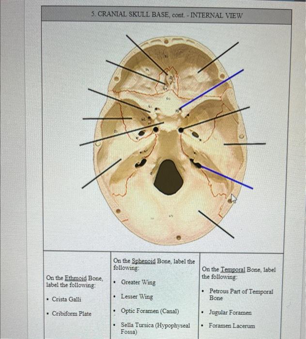 Solved cranial skull base internal view label | Chegg.com