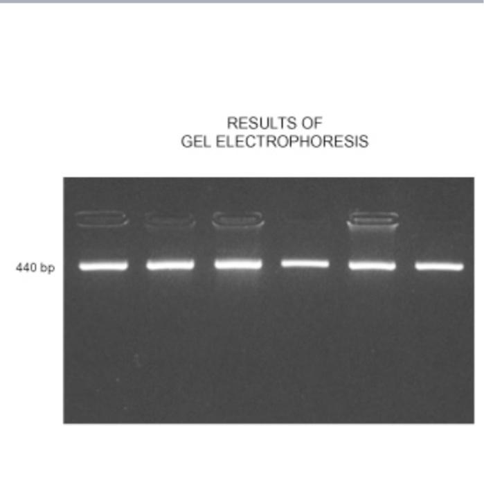 Solved RESULTS OF GEL ELECTROPHORESIS | Chegg.com