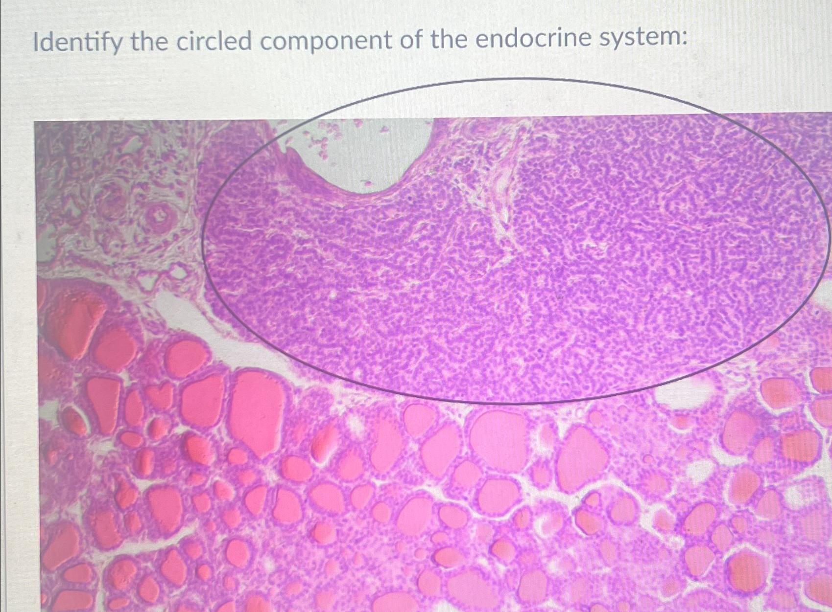 Solved Identify the circled component of the endocrine | Chegg.com
