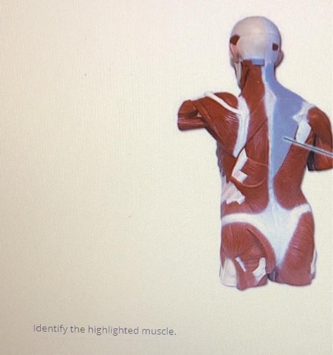 Solved Identify the highlighted muscle. LT What are the | Chegg.com