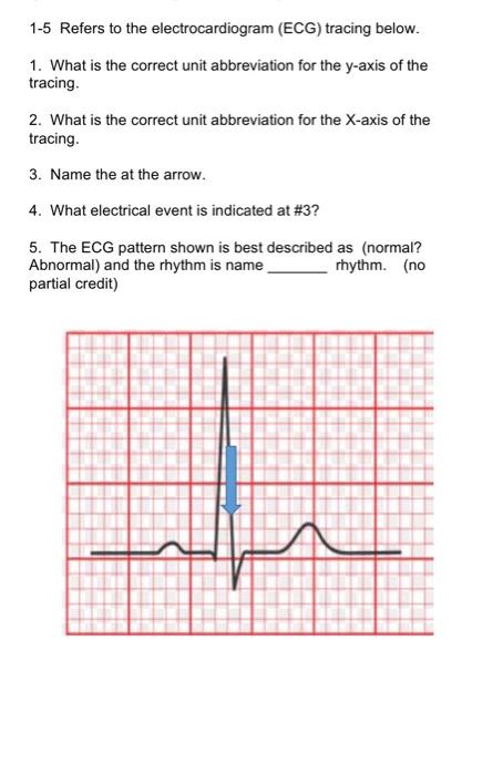 [Solved]: 1-5 Refers to the electrocardiogram (ECG) tracing