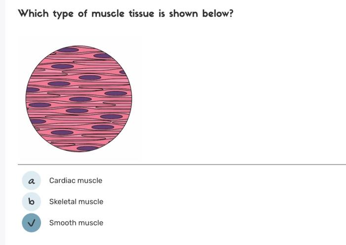 Solved Which type of muscle tissue is shown below? Cardiac | Chegg.com