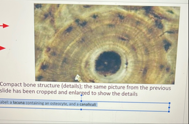 Compact bone structure (details); the same picture | Chegg.com