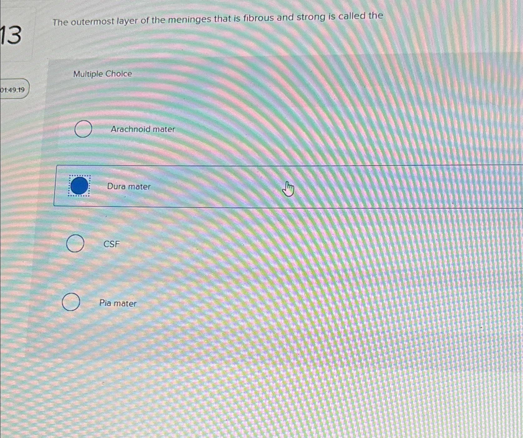 Solved 13The outermost layer of the meninges that is fibrous | Chegg.com