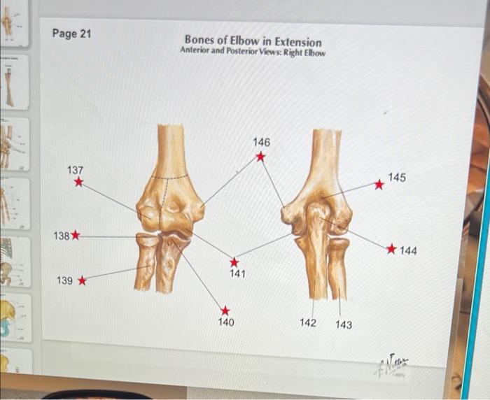 Solved Bones of Elbow in Extension Anterior and Posterior | Chegg.com