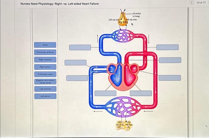 Solved Nurses Need Physiology: Right- vs. Left-sided Heart | Chegg.com