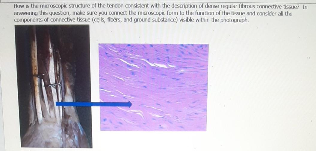 Solved How is the microscopic structure of the tendon | Chegg.com