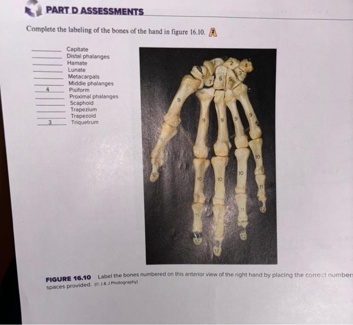 Solved FIGURE 16.9 Identify the bones indicated on this | Chegg.com
