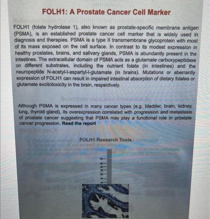 Solved As stated in the description of FOLH1, it is a | Chegg.com