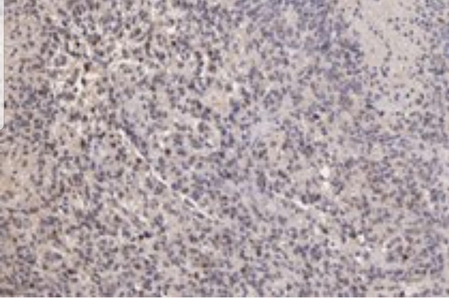 Solved Analyse and interpret the below samples stained | Chegg.com