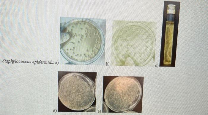 Staphylococcus Epidermidis Streak Plate