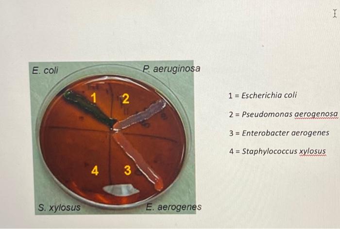 Solved Escherichia coli ATCC 25922 1 E. coli P. aeruginosa | Chegg.com