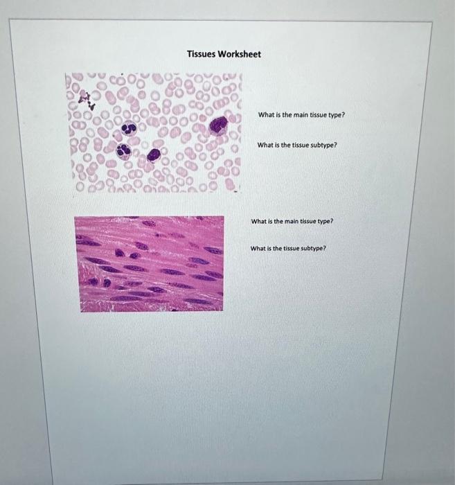 Solved −Tissues Worksheet What is the main tissue type What | Chegg.com
