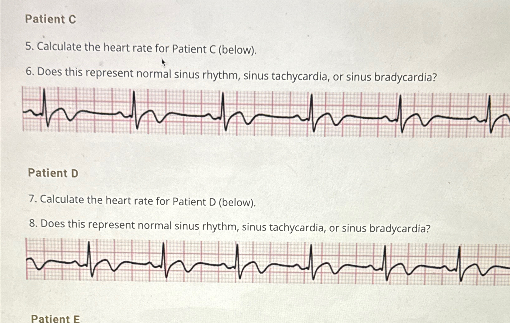 Solved Patient C5. ﻿Calculate the heart rate for Patient C | Chegg.com
