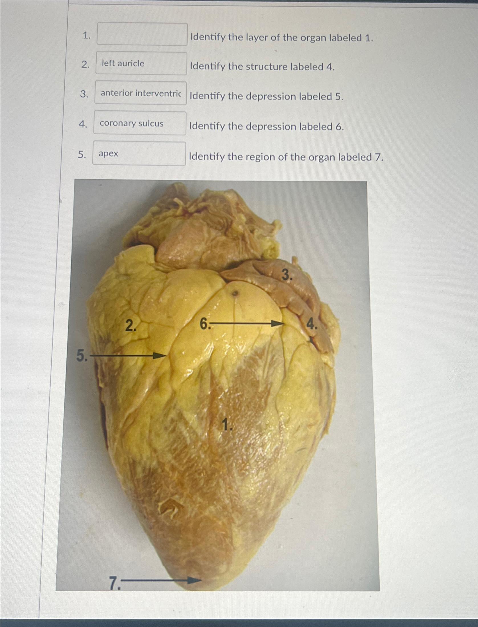Solved Identify the layer of the organ labeled 1.Identify | Chegg.com