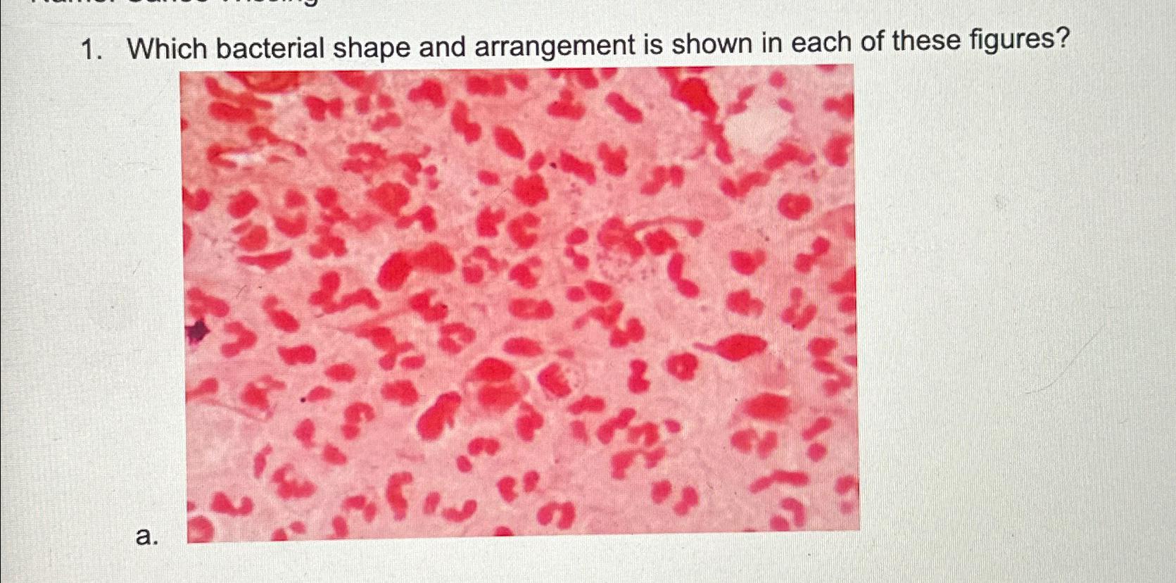 Solved Which bacterial shape and arrangement is shown in | Chegg.com